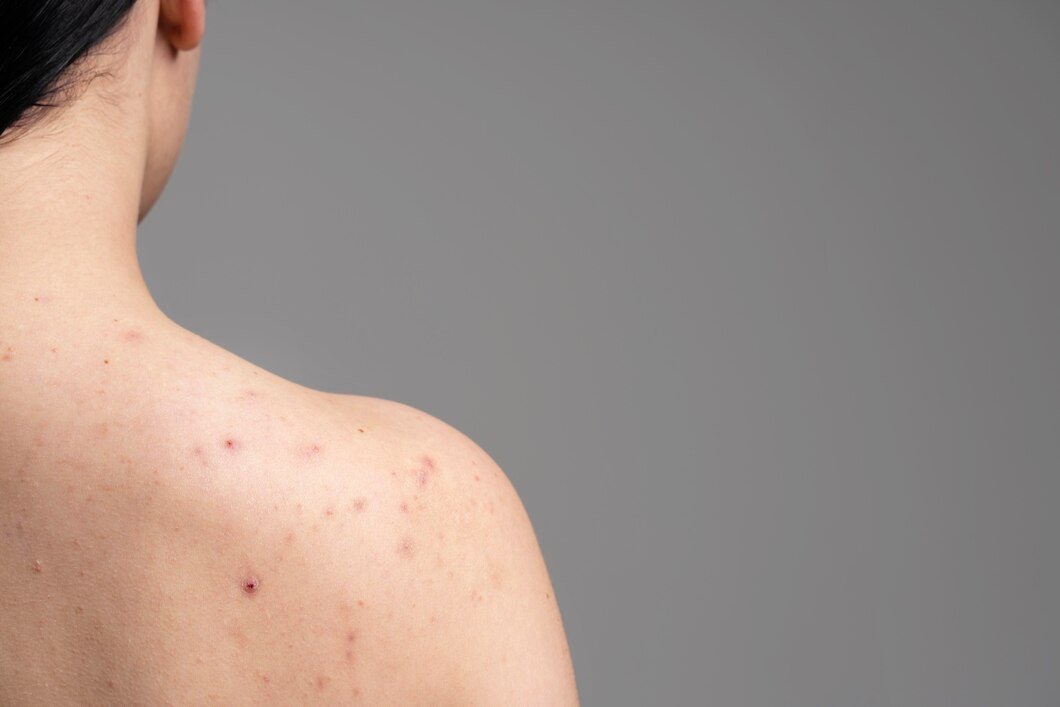 When To Apply Soothing Products After A Skin Reaction – Hey Honey Beauty